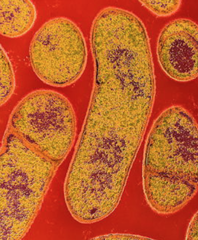 Botulism Outbreak Reported at Valley Oak Food and Fuel | Food Poison ...