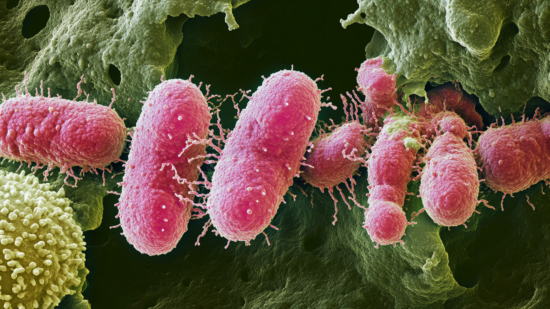 E. coli and its sometimes deadly result Hemolytic Uremic Syndrome (HUS ...